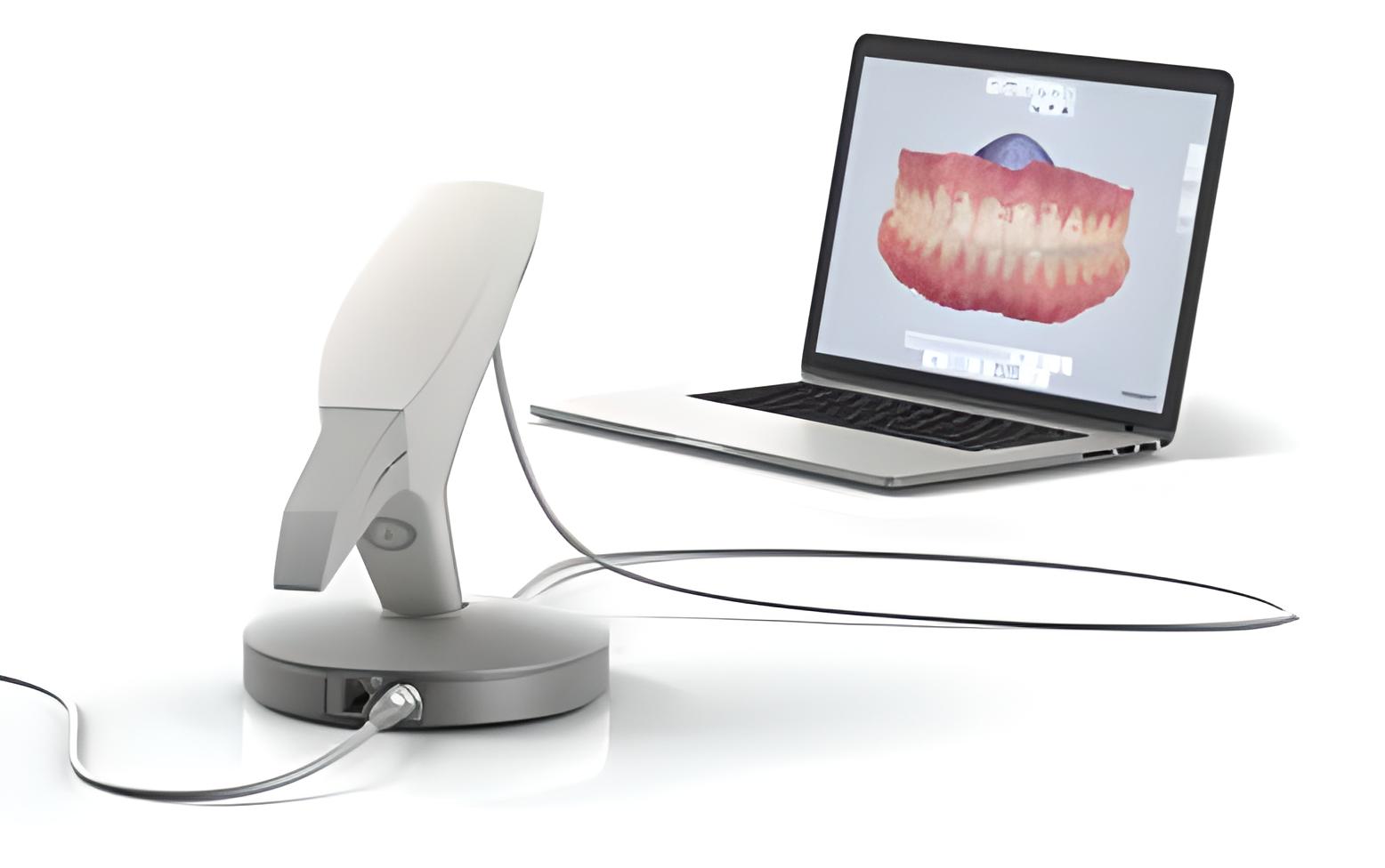 Clínica Durán | Escáner Intraoral